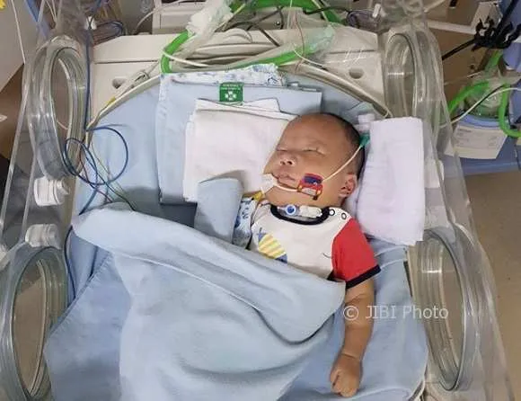 Bayi Model Video Klip RAN Meninggal Dunia - Espos.id