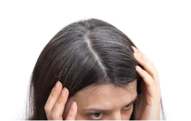 Awas! Uban Bisa Muncul di Usia Muda, Ketahui Penyebabnya - Espos.id